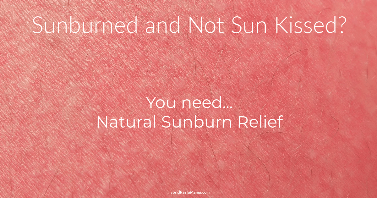 Soothe Your Sunburn Naturally: Relief Tips & Tricks | Hybrid Rasta Mama
