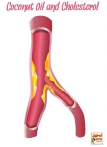 Coconut Oil and Cholesterol | Hybrid Rasta Mama